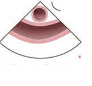 TEE Learning Platform - Interactive Transesophageal Echocardiography ...