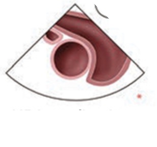 TEE Learning Platform - Interactive Transesophageal Echocardiography ...