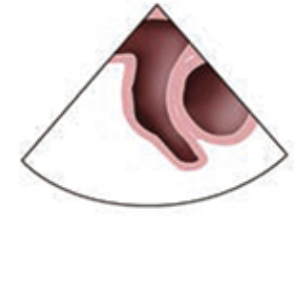 TEE Learning Platform - Interactive Transesophageal Echocardiography ...