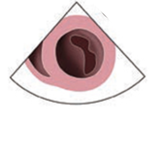 TEE Learning Platform - Interactive Transesophageal Echocardiography ...