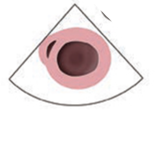 TEE Learning Platform - Interactive Transesophageal Echocardiography ...