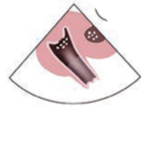 TEE Learning Platform - Interactive Transesophageal Echocardiography ...