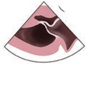 TEE Learning Platform - Interactive Transesophageal Echocardiography ...