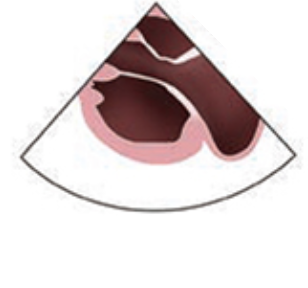 TEE Learning Platform - Interactive Transesophageal Echocardiography ...