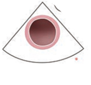 TEE Learning Platform - Interactive Transesophageal Echocardiography ...